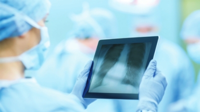 Groundbreaking Emphysema Treatment | Inova